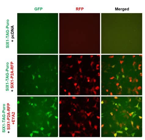 Six1 Reporter Lentivirus Lipexogen Biotech