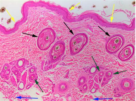 Skin Lab 2 Endocrine And Inflammatory Flashcards Quizlet