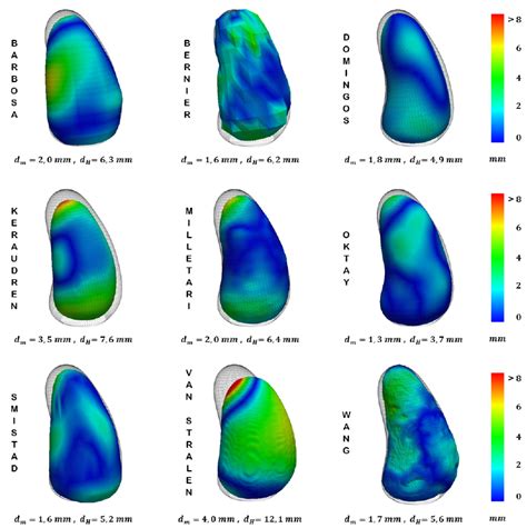 Example Of Lv Segmentation Results Obtained From The Same Particular