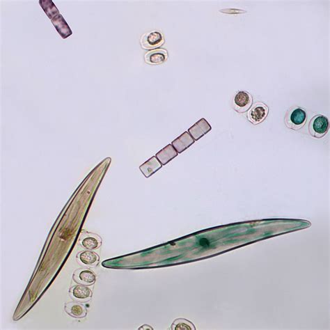 Diatoms Under Microscope