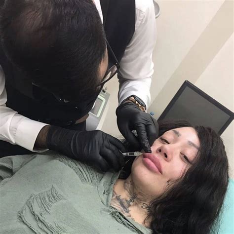 Mutya Buenas Plastic Surgery Journey Bizrahmed