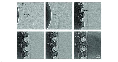 Typical X Ray Images Showing The Water Filling Flow In The