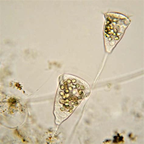 Vorticella Slide
