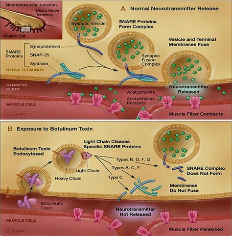 Botulism A Rare But Deadly Disease How Did Clostridium Botulinum Get