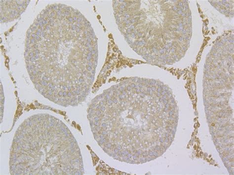 Trpv6 Polyclonal Antibody Pa5 141059
