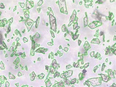 Image Analysis Solutions Image Analysis Software