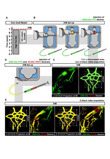 Assessment Of Microvessel Permeability In Murine Atherosclerotic Vein Grafts Using Two Photon