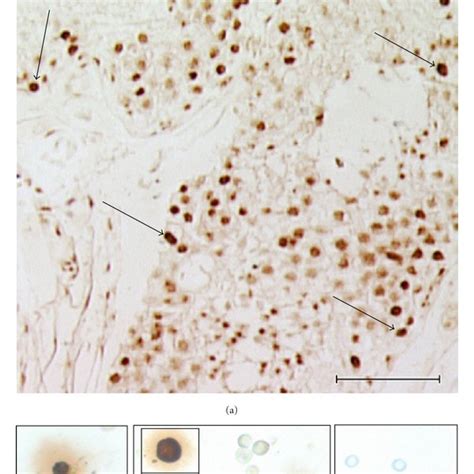 Immunolocalization Of 5 Methyl Cytosine On Adult Human Testicular
