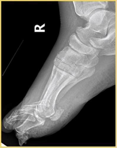 Preoperative Testing And Medical Management Combined Flashcards Quizlet