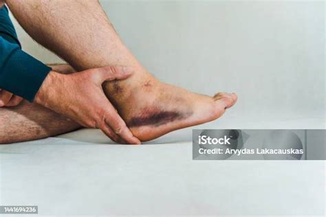 발목을 삐고 부어 오른다 남자는 집에서 삔 발목을 잡고 있습니다 발목 염좌 부상흰색 회색 배경 복사 공간 건강관리와 의술에 대한