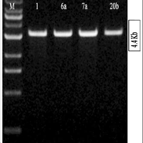 Pcr Amplification Showed 15 Kb Band Size According To 16s Rrna Gene M