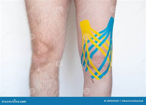 Knee Taping After Knee Surgery And Meniscus Replacement Rehabilitation And Recovery After