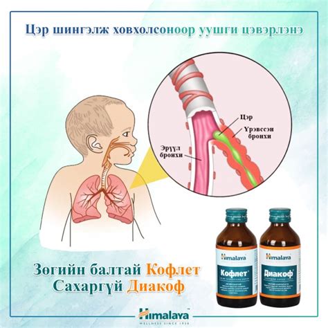 Гуурсан хоолойн бачуурал буюу уушгины бронхитын үеийн гэрээр авах арга хэмжээ “ЦАХИУР ТӨМӨР” ХХК