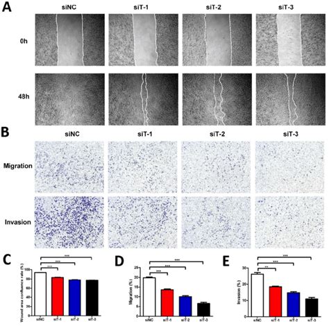 Cancer Cells Cultured With Conditional Medium From Tiam2 Silenced