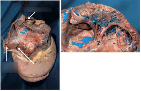 Right Atrium Diagram Quizlet