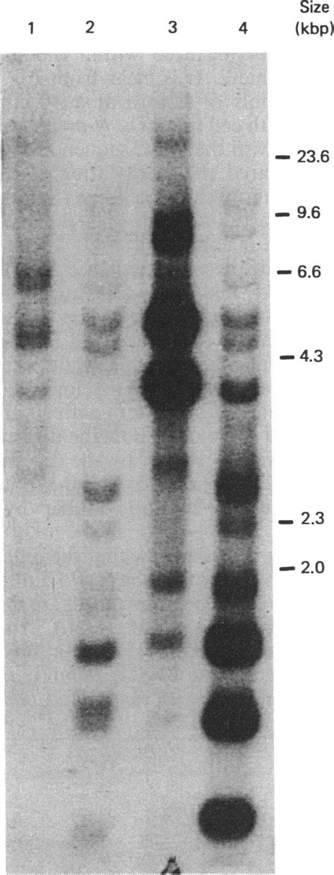 Restriction Enzyme Analysis Of Odc Sequences In Genomic Dna Isolated