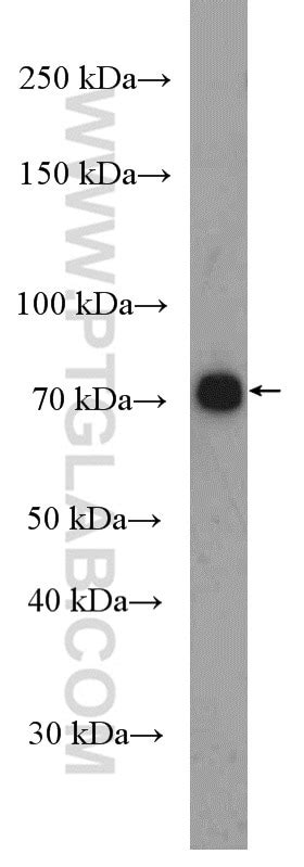 Dmt1 Antibody 20507 1 Ap Proteintech