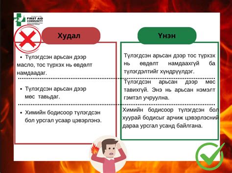 Гараа түлчихээд масло барааны саван түрхдэг гэдэгт итгэсээр байгаа юм биш биз😧 Түлэгдэлтийн