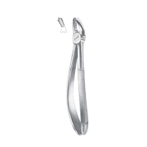 Fig 17 Upper Molars Right Curemed International