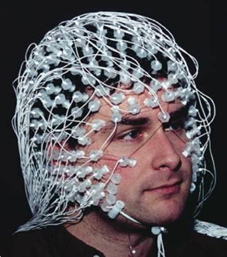Dense Array Eeg And Epilepsy Intechopen