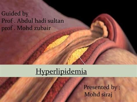 Classification Cardiovascular Drugspptx