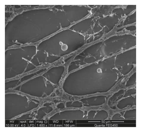 Preparation And Performance Evaluation Of Polymeric Microspheres Used