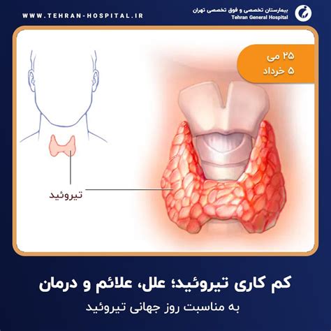 کم کاری تیروئید؛ علل، علائم و درمان بیمارستان تهران ⭐️