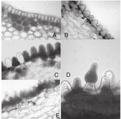 “ig 4 Various Shapes Of Upper Epidermal Cells Found In The