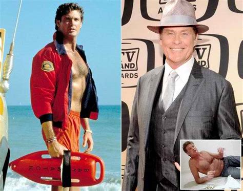 David Hasselhoff Plastic Surgery