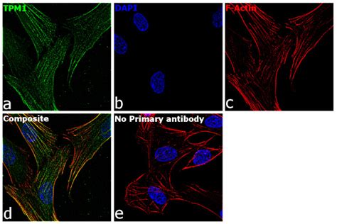Tpm1 Polyclonal Antibody Pa5 29846