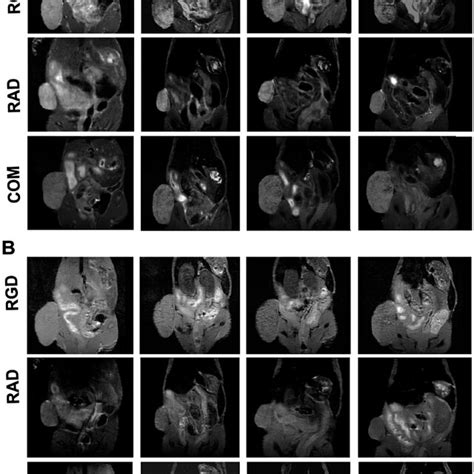 A And B T2 And T1 Weighted Mri Of Mice Intravenously Injected With