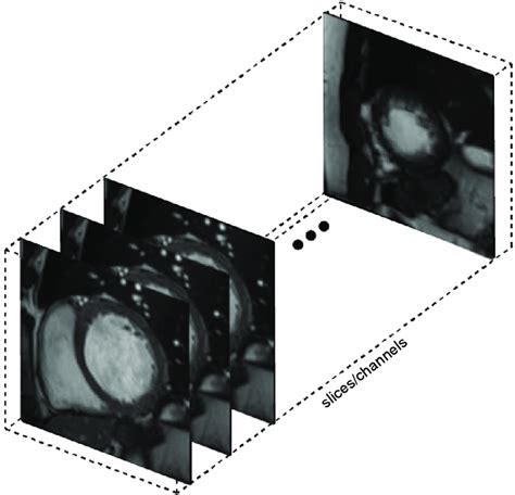 3 One Of Preprocessed 3d Cardiac Data From Acdc Dataset The Cardiac