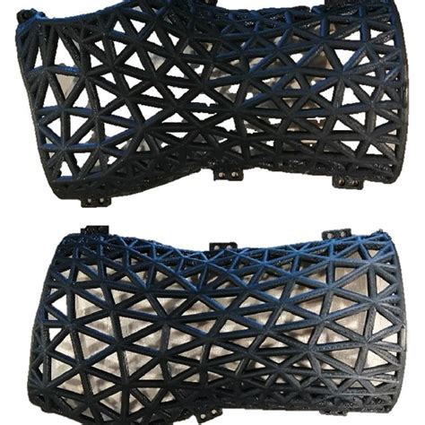 The 3d Printed Splint Perfectly Covers The Wrist The Radius Of The
