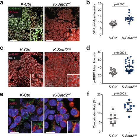 Setd2 Deficient Tumors Have Increased Protein Synthesis And High Mtorc1 Download Scientific