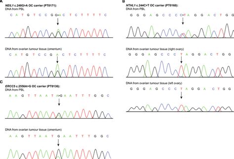 Loss Of Heterozygosity Analyses Of Candidate Genes Loci Sanger