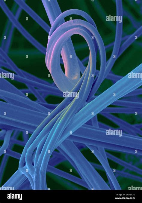 Coloured Scanning Electron Micrograph Sem Of Northern Black Widow