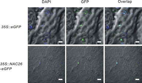 Subcelluar Localization Of Vanac26 In Tobacco Epidermis Nicotiana