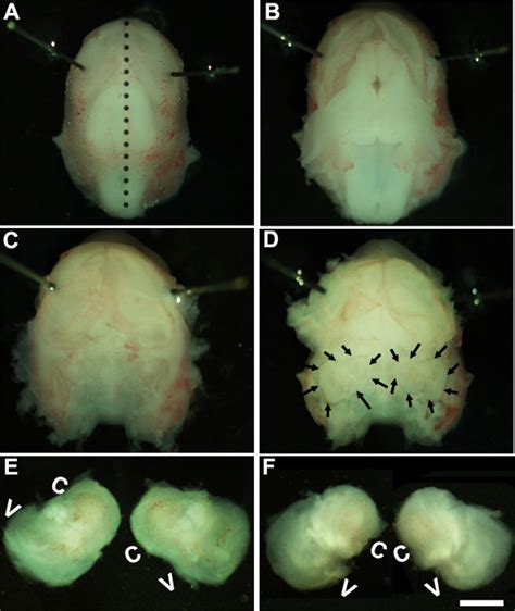 Culture Of Embryonic Mouse Cochlear Explants And Gene Transfer By