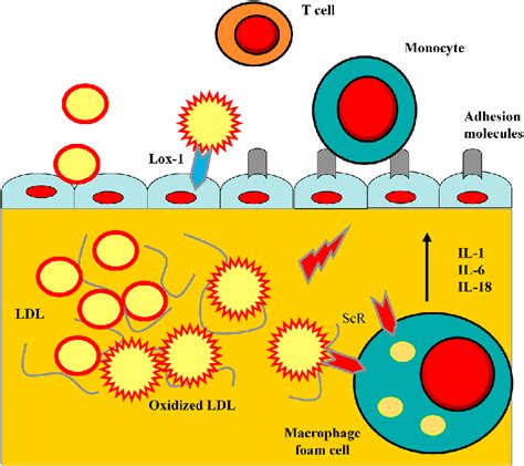 Activation Of Innate Inflammatory Responses By Oxidized Ldl Ldl Pass
