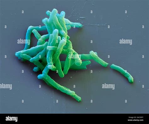 Tuberculosis Bacteria Coloured Scanning Electron Micrograph Of