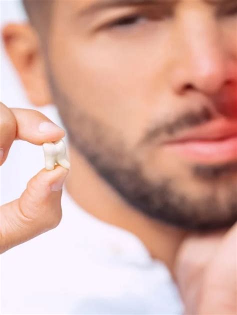 5 Ways To Reduce Tooth Subluxation Effective Injury Management