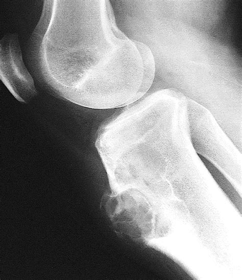Pathology Mcqs For Various Entrance Exams