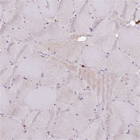 Rabbit Polyclonal Anti Pycard Antibody Buy For Research Highly