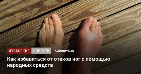 Как избавиться от отеков ног в домашних условиях