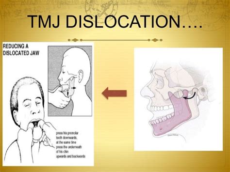 Tmj And Its Relation To Periodontics