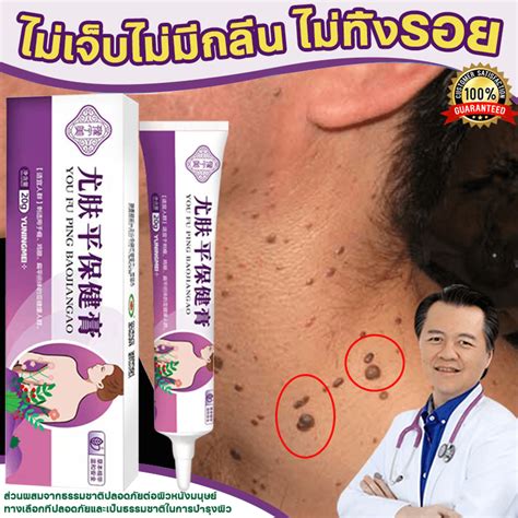 ครีมทาผิว มอยเจอร์ไรเซอร์ ครีมกำจัด 20g หูดตาปลาและติ่งเนื้อ ไฝ แต้ม ทา