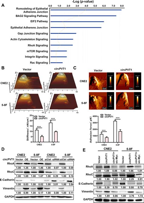 Circpvt1 Promotes The Migration And Invasion Of Npc Cells By Regulating