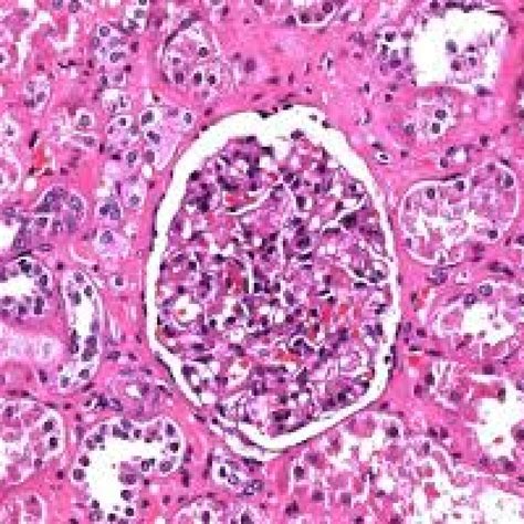 Hematoxylin Solution Modified Acc To Gi