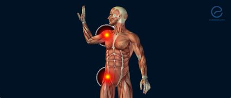 Endometriosis A Whole Body Disease Endonews