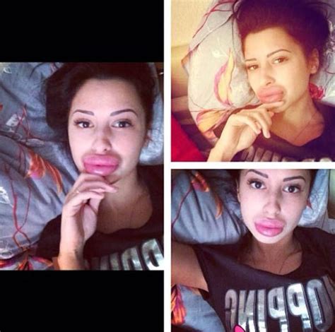 Anya Flaunts Her Massive Fake Lips 21 Pics